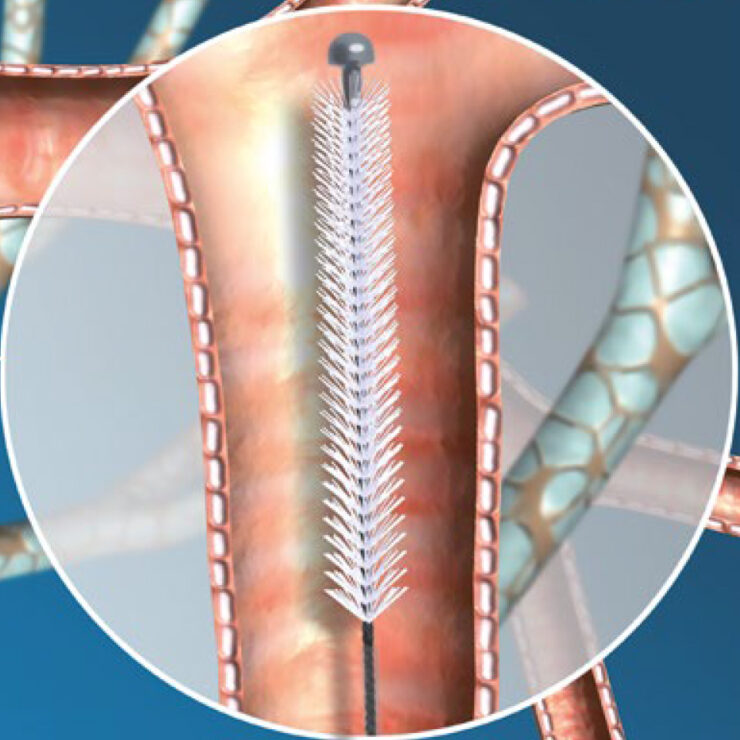 Cytology Brushes - Micro-Tech UK