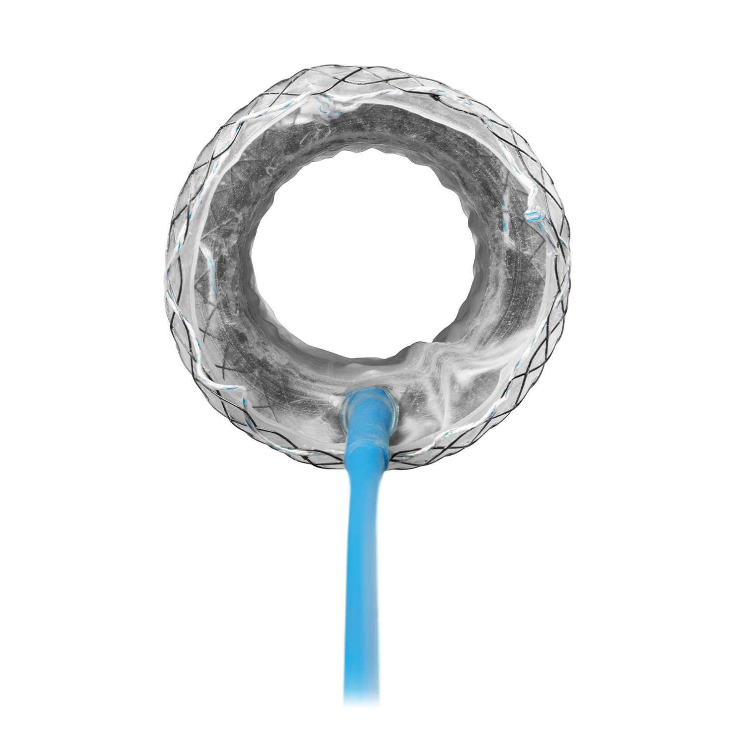 VacStent GI™ Colon - Micro-Tech UK